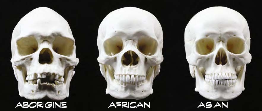 "Missy Skull" Unexplained Skull Study