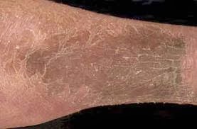 Medical Treatment Pictures-for Better Understanding: Acquired ...