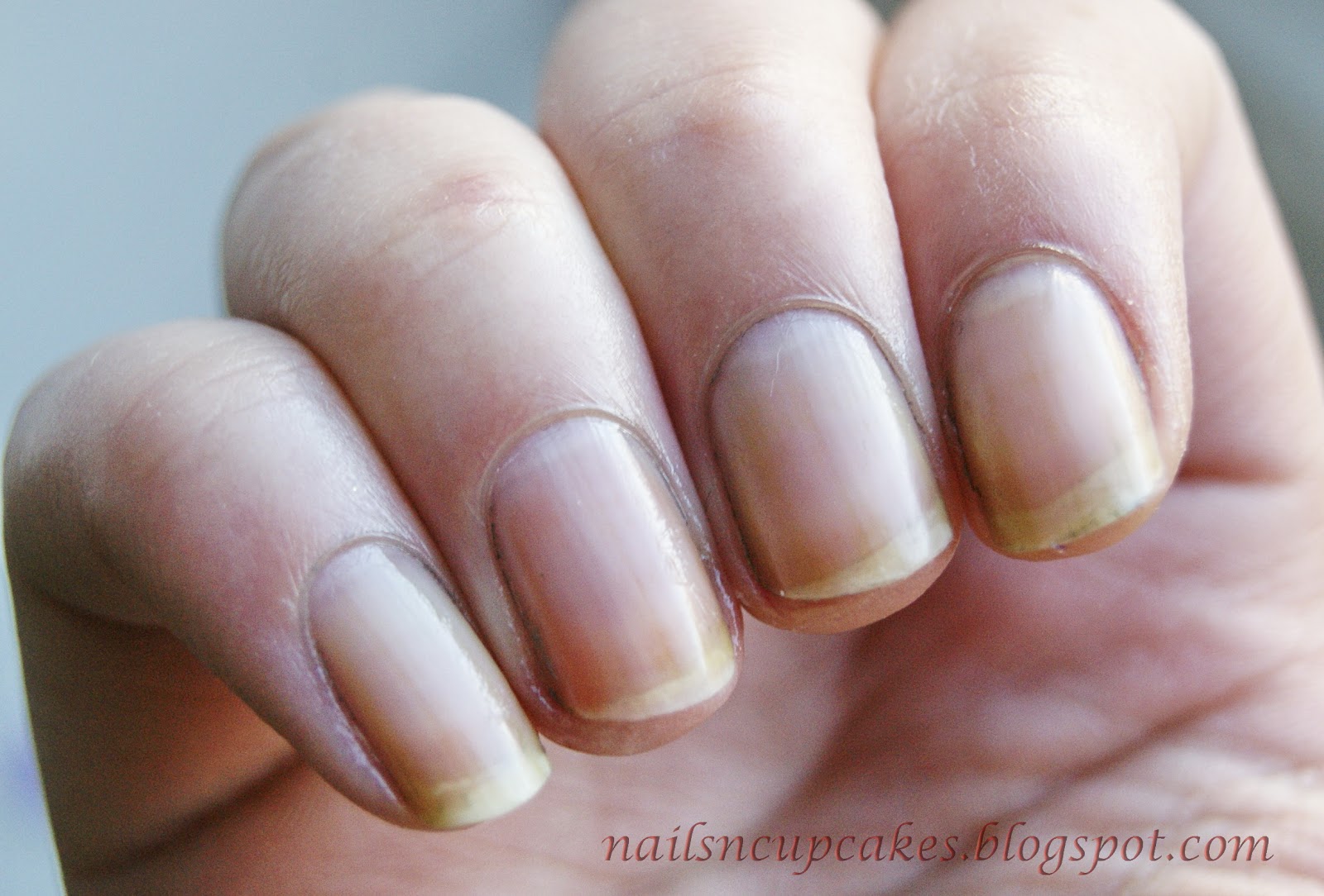 NailsN'cupcakes: Guide to get rid of ridges and yellow nails!
