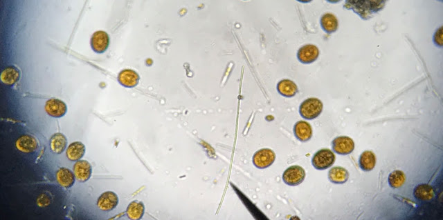 A Transgenic World: Dinoflagellates in the Reef Tank - What, Why, and How?