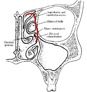 Tutorials in otolaryngology: Centripetal endoscopic sinus surgery