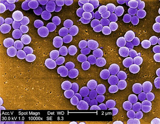 Bugs, Drugs & Global Health : Using HIV Drugs for Staphylococcus aureus ...