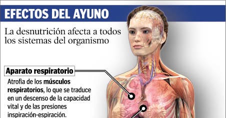 imágeneshistóricas.blogspot.es: Inanición