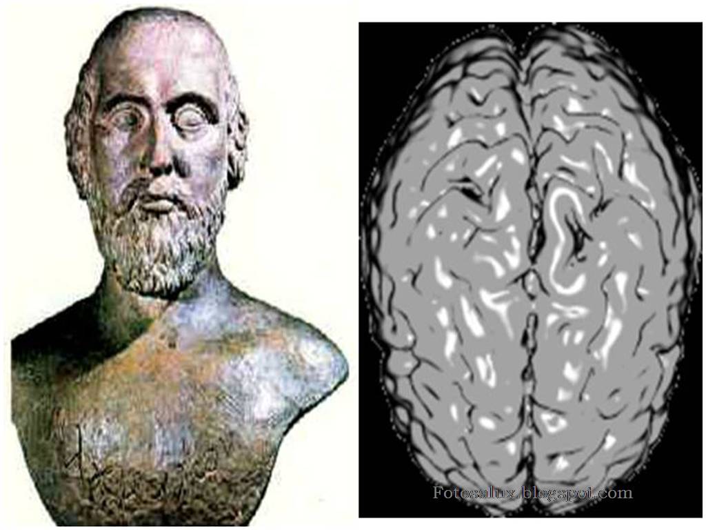 Alcmeón un principal en historia de la medicina.