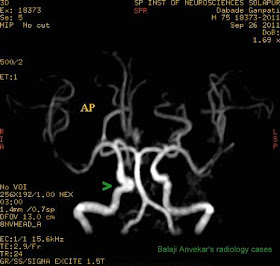 Dr Balaji Anvekar FRCR: 01/09/2011 - 01/10/2011
