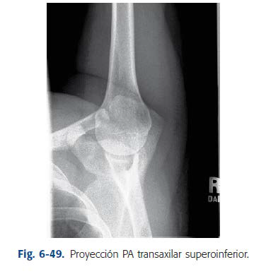 PRODUCCION Y TRATAMIENTO DE IMAGENES DIAGNOSTICAS: CAPITULO HUMERO Y ...