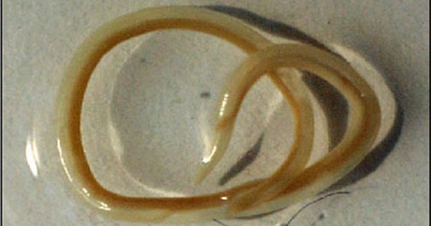 EL MUNDO DE LA ALIMENTACIÓN SANA: EL ANISAKIS