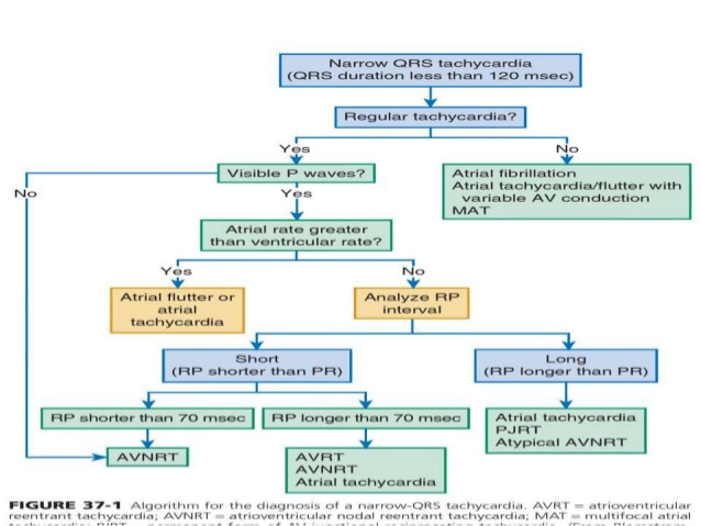 Cardiology window: ECG PSVT