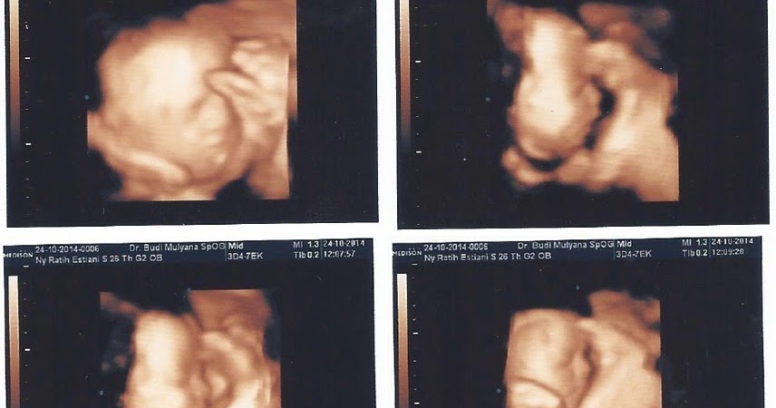Sweet Life: USG 4D di 30minggu kehamilan