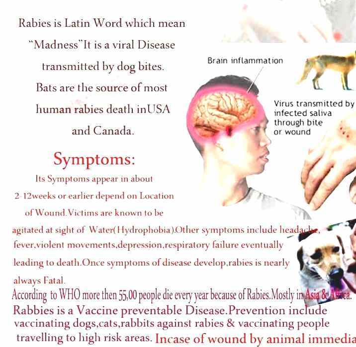 Rabies - Signs Of Rabies In A Human
