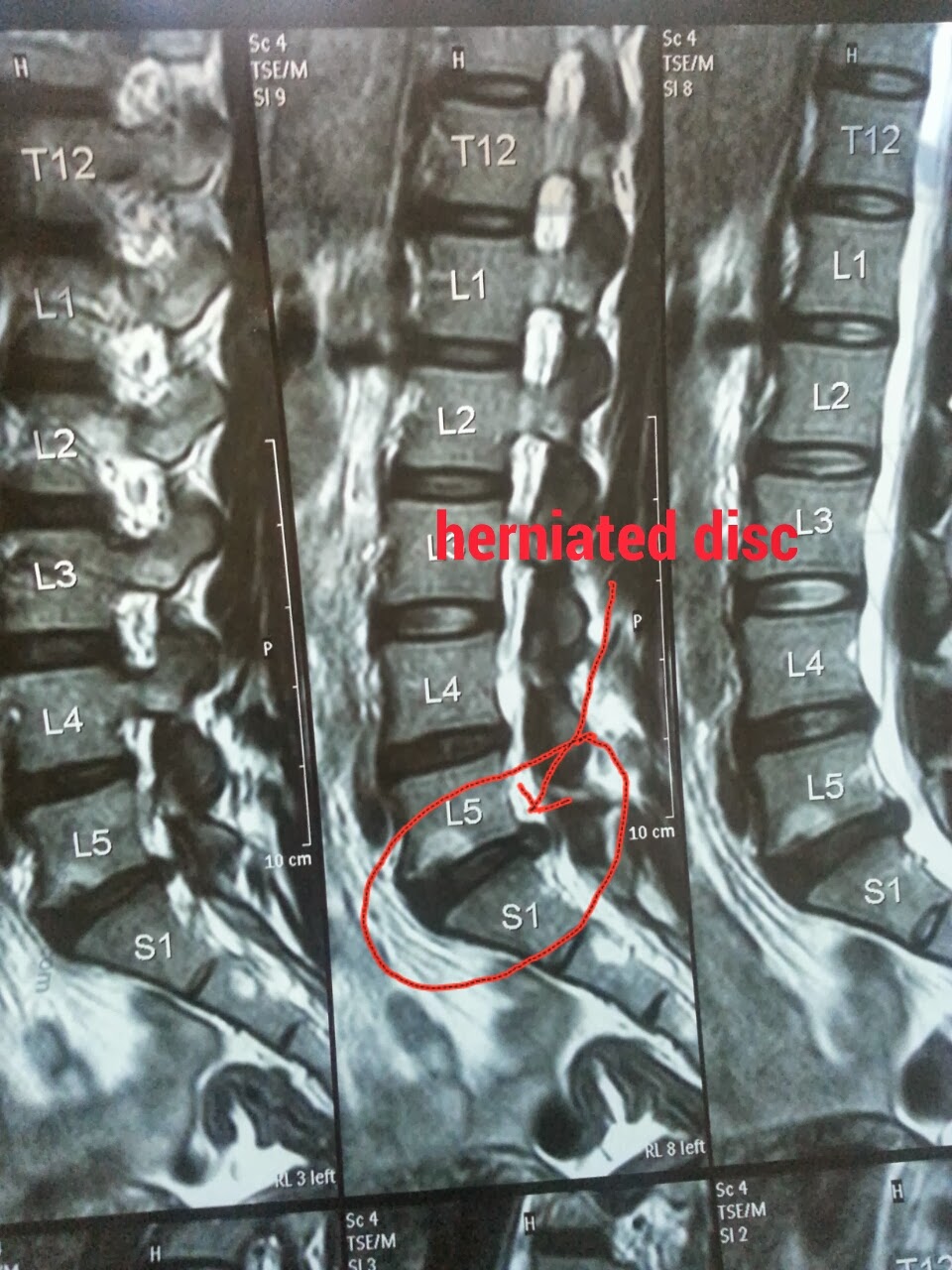 Kata Uni: HNP, Go Away and DONT Come Back!