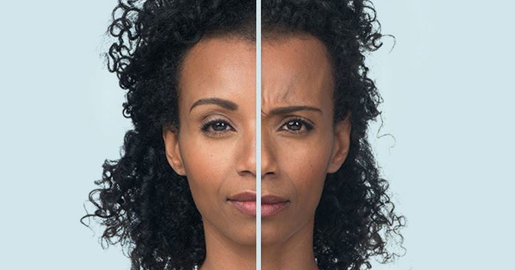 Botox Injections: Purpose, Side Effects & Warnings