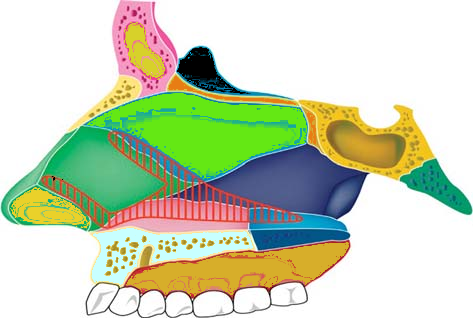 drtbalu's otolaryngology resources: Modified septoplasty