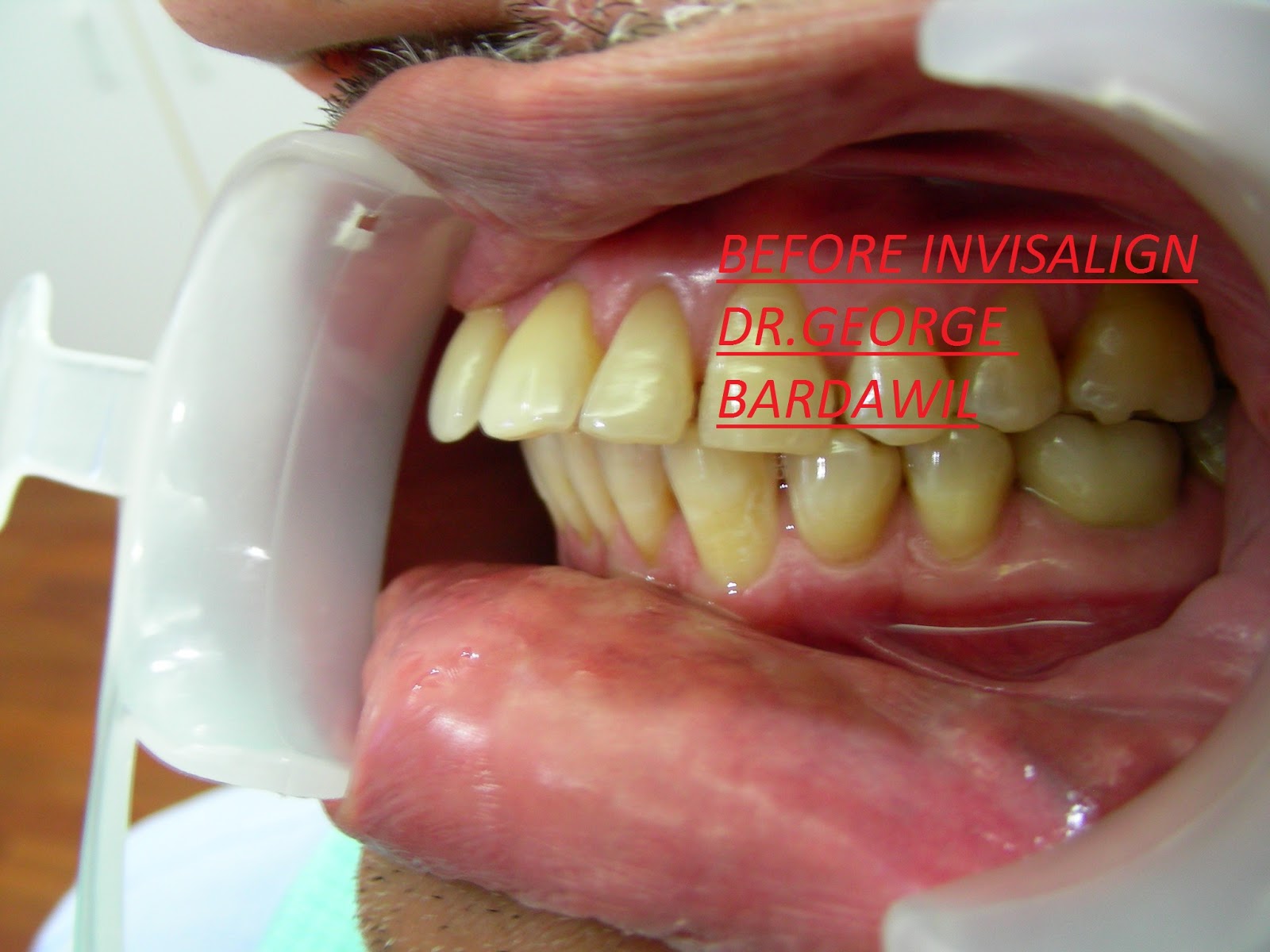 Dr.George E. Bardawil-Orthodontist-Invisalign Diamond level ...