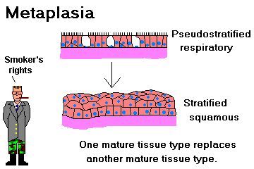 EXAMS AND ME : Metaplasia