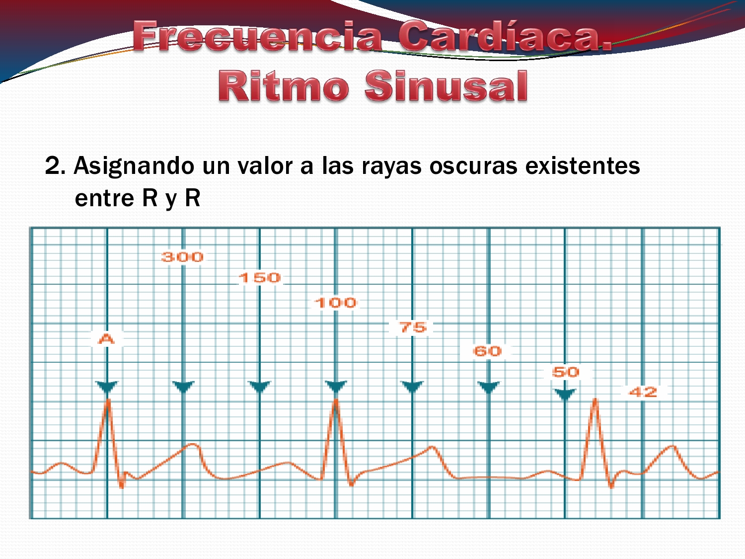 TEMAS MÉDICOS: ELECTROCARDIOGRAMA NORMAL