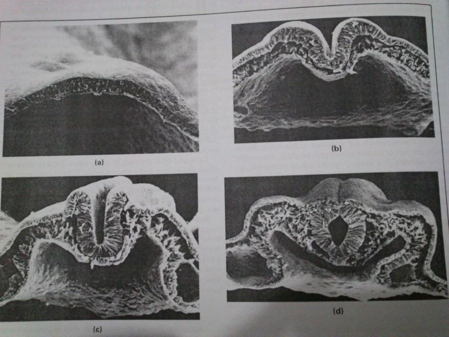 BELAJAR...: Bab 12 Neurulasi dan Sumbu Induksi