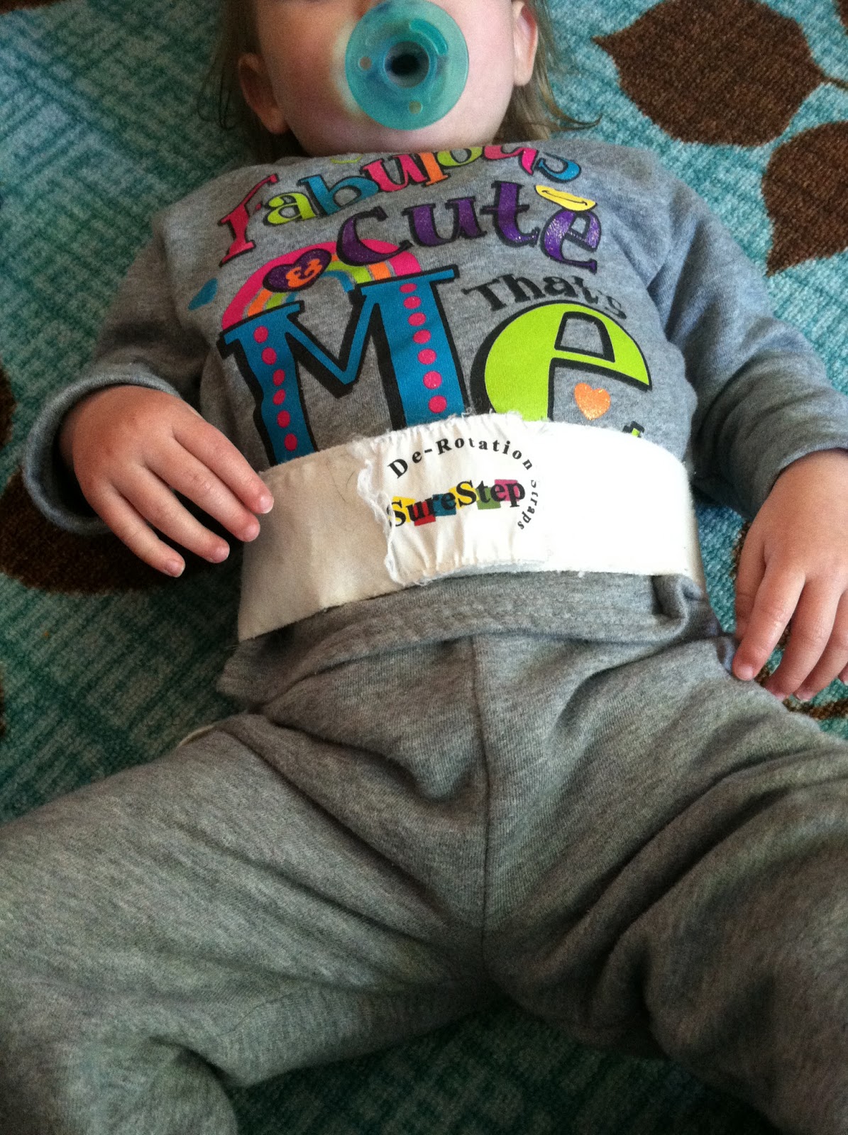 Rachel's Journey with Spina Bifida: De-Rotation Straps Tutorial