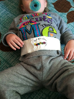 Rachel's Journey with Spina Bifida: De-Rotation Straps Tutorial