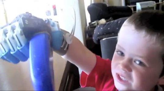 retina: Photos : 5-Year-Old Boy Born Without Fingers Gets Robotic Hand ...