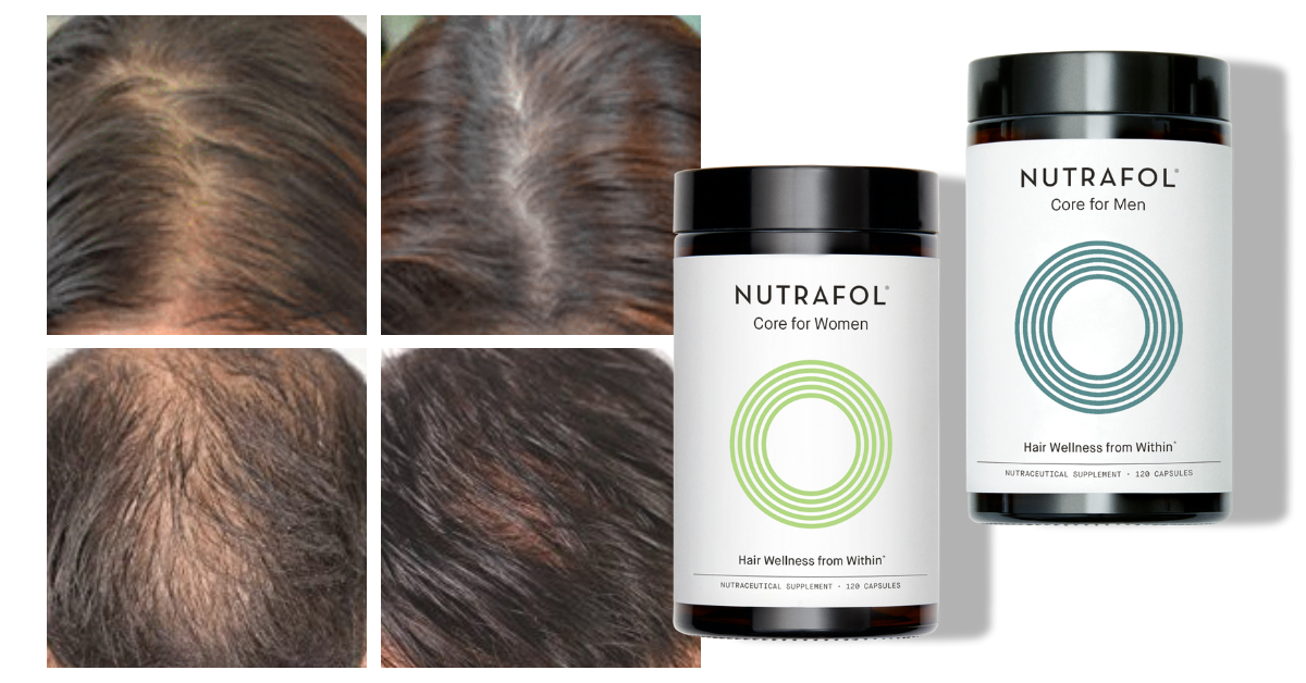 Nutrafol or HR23+: Which is Better? - Hair Loss Review Centre