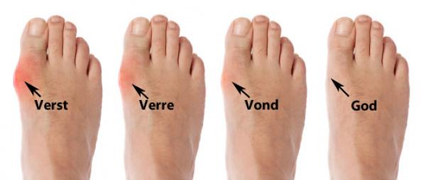 Treningsidiot!: Urinsyregikt og Kosthold