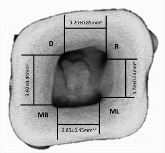 The Root Canal Anatomy Project: JOE Publication: Radix