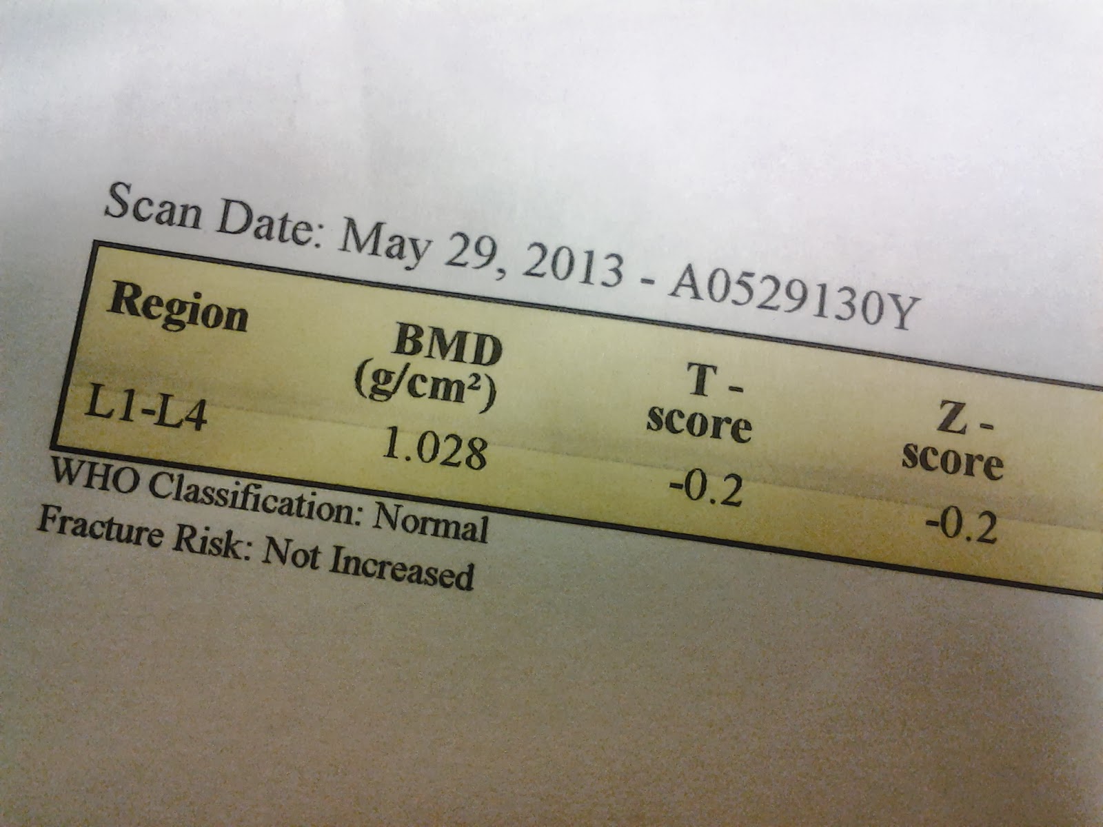 How I complicated my life today: DEXA scan bone density test