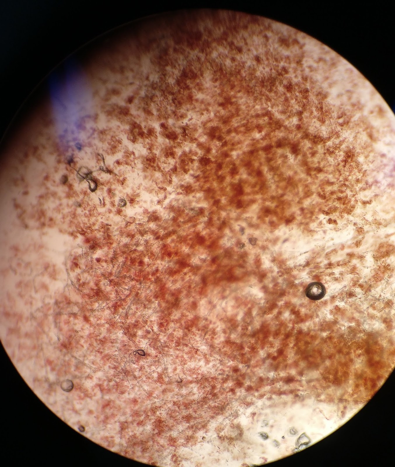 Práctica 8: Examen de mohos al microscopio óptico.