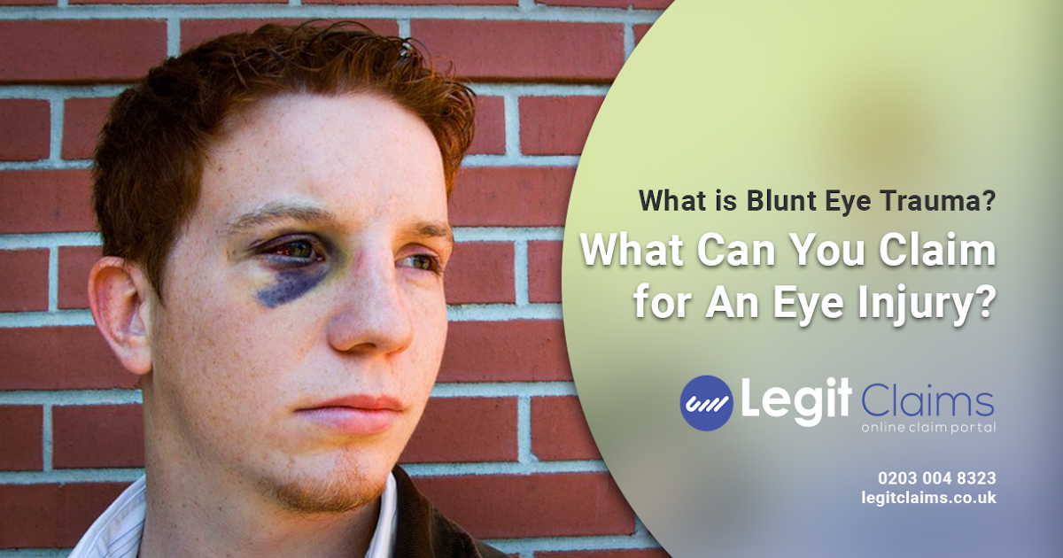The Steps of Claiming for a Blunt Eye Trauma - LEGIT CLAIMS | PERSONAL ...