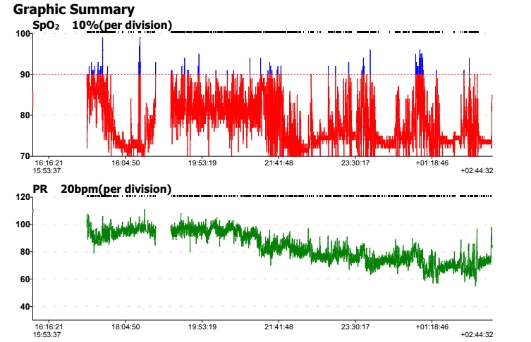 Sleep apnea : SPO2 @ 12000 feet elevation