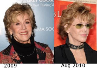Jane Fonda Plastic Surgery Before and After Facelift | Plastic Surgery