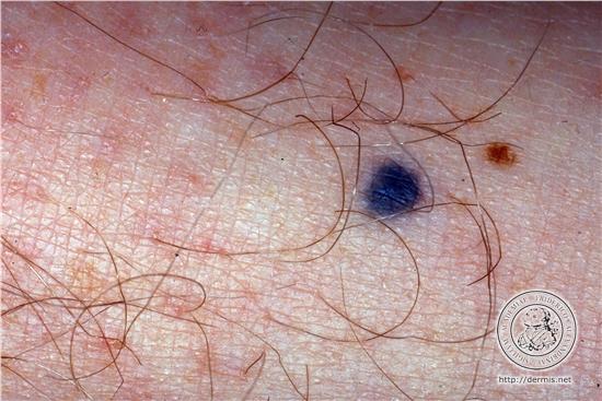 Semiología Quirúrgica : Examen de cabeza.