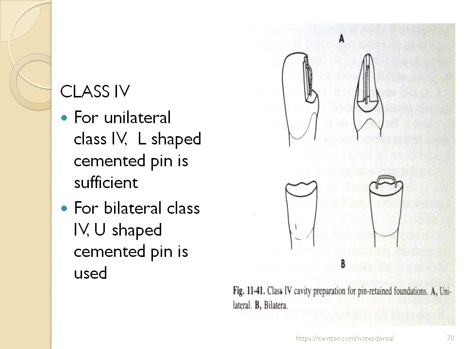 Dental Notes: Pin Retained Restorations NOTES