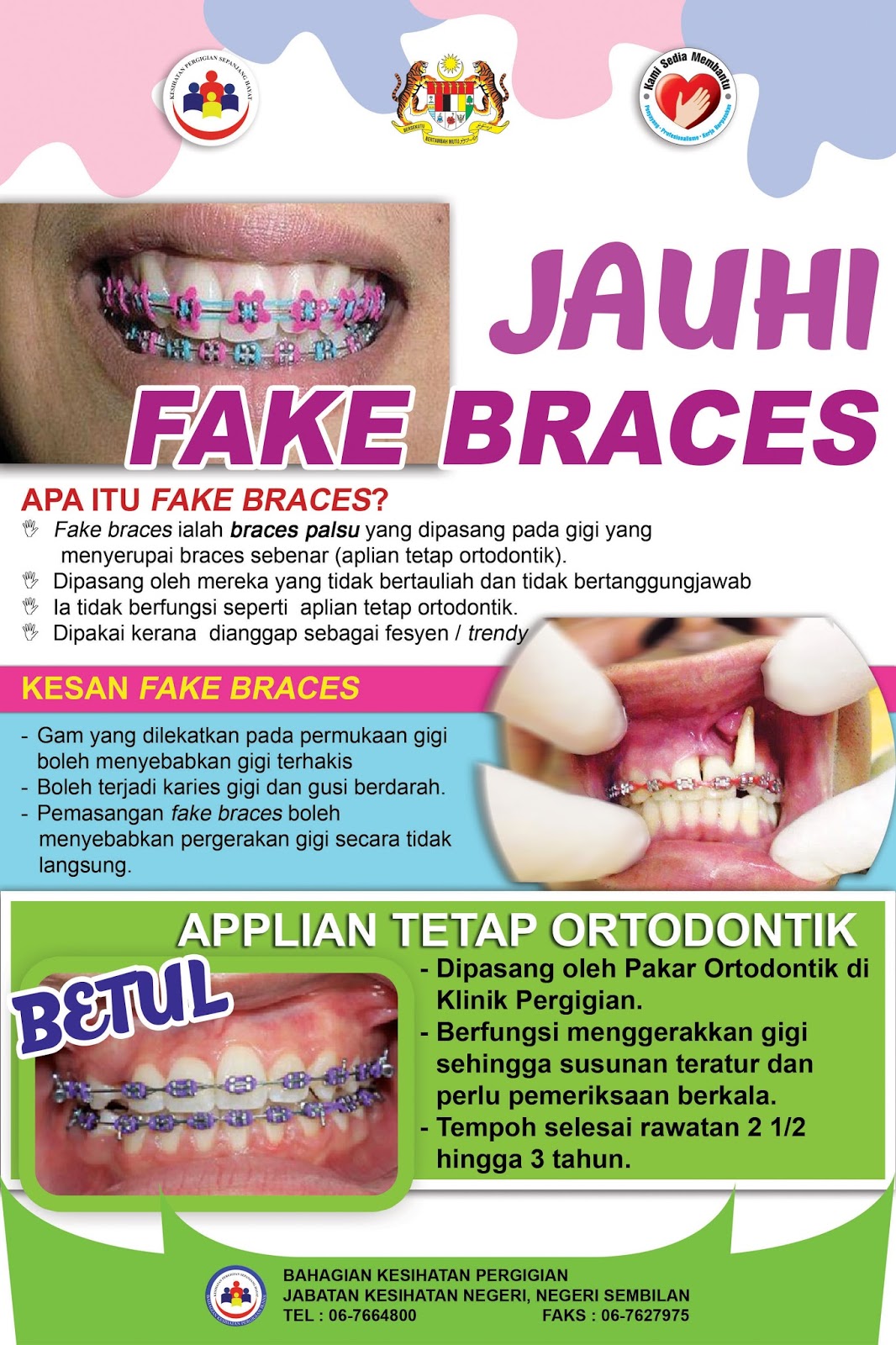 Blog Rasmi Bahagian Kesihatan Pergigian Negeri Sembilan: JAUHI FAKE BRACES