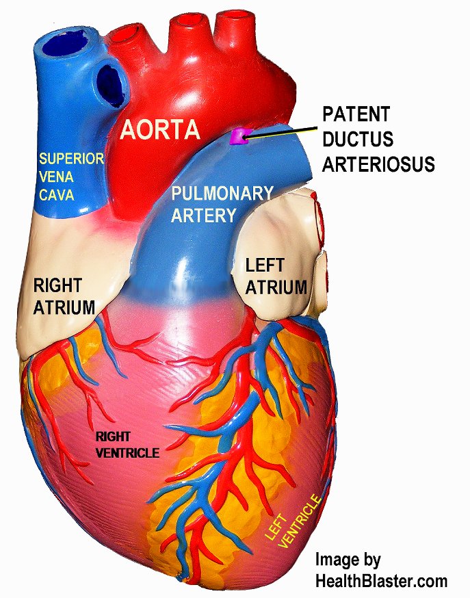 Kellisa's Path: PDA Ligation