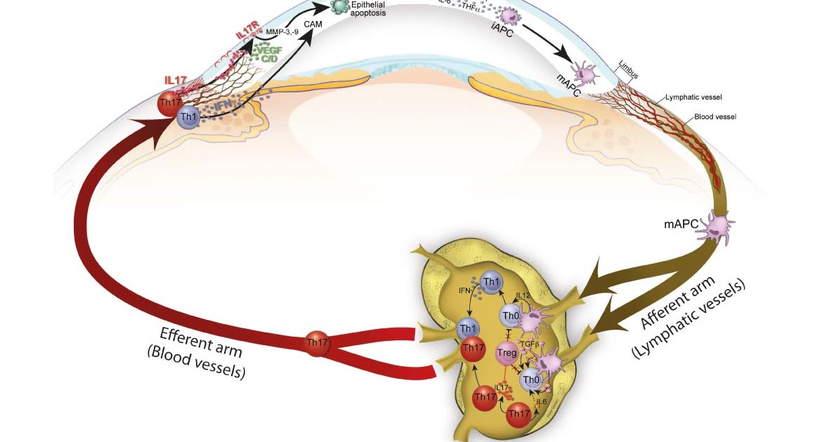 Dry eye _ Peter Mallen