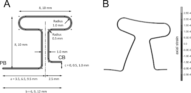 T-loop force system with and without vertical step using finite element ...