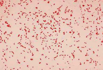 Medicina hermosa vocación.: Acinetobacter baumannii-calcoaceticus