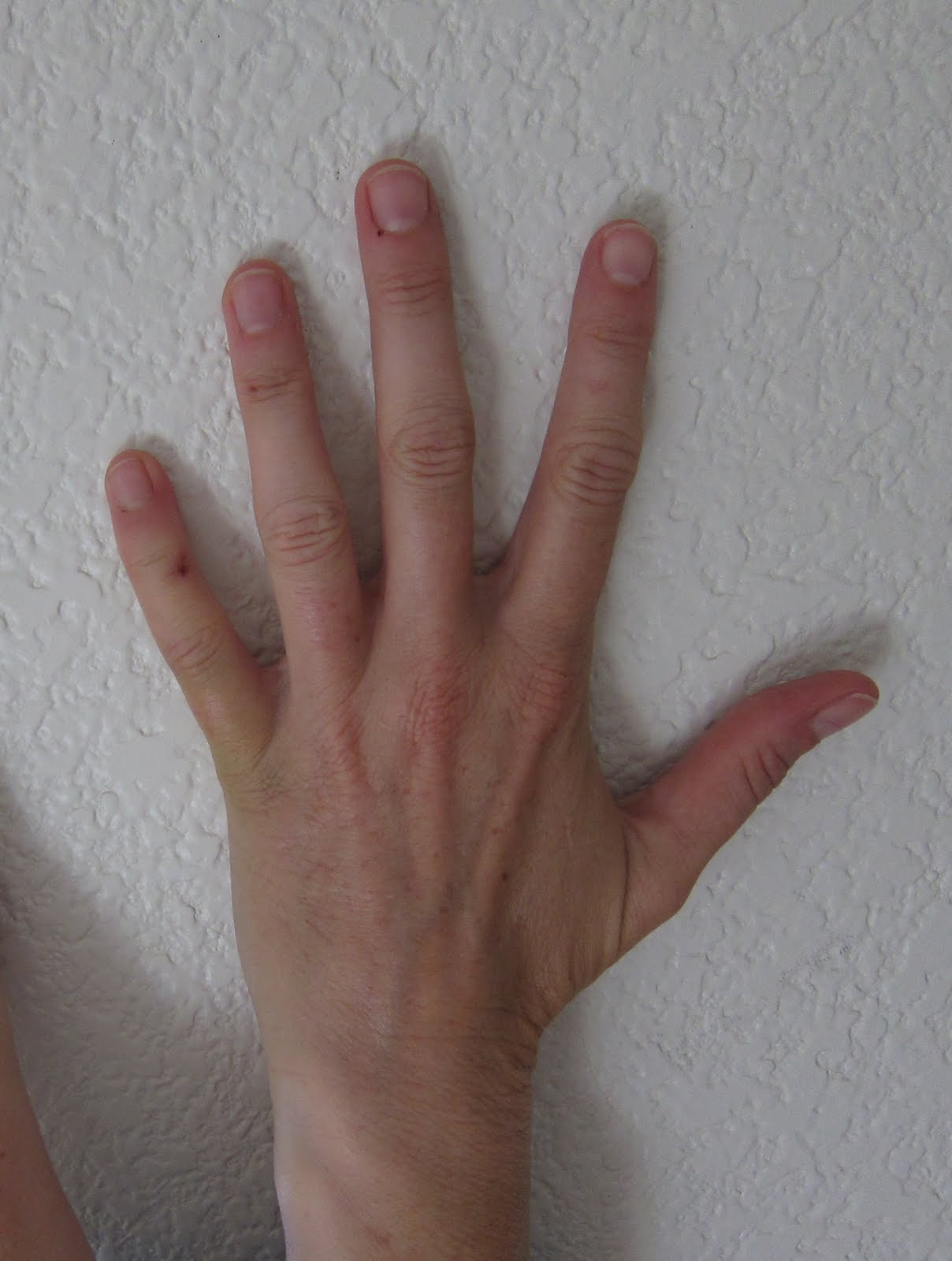 Mustang Adventures: Broken finger!