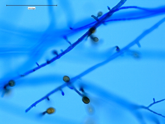 Fun With Microbiology (What's Buggin' You?): Stemphylium species