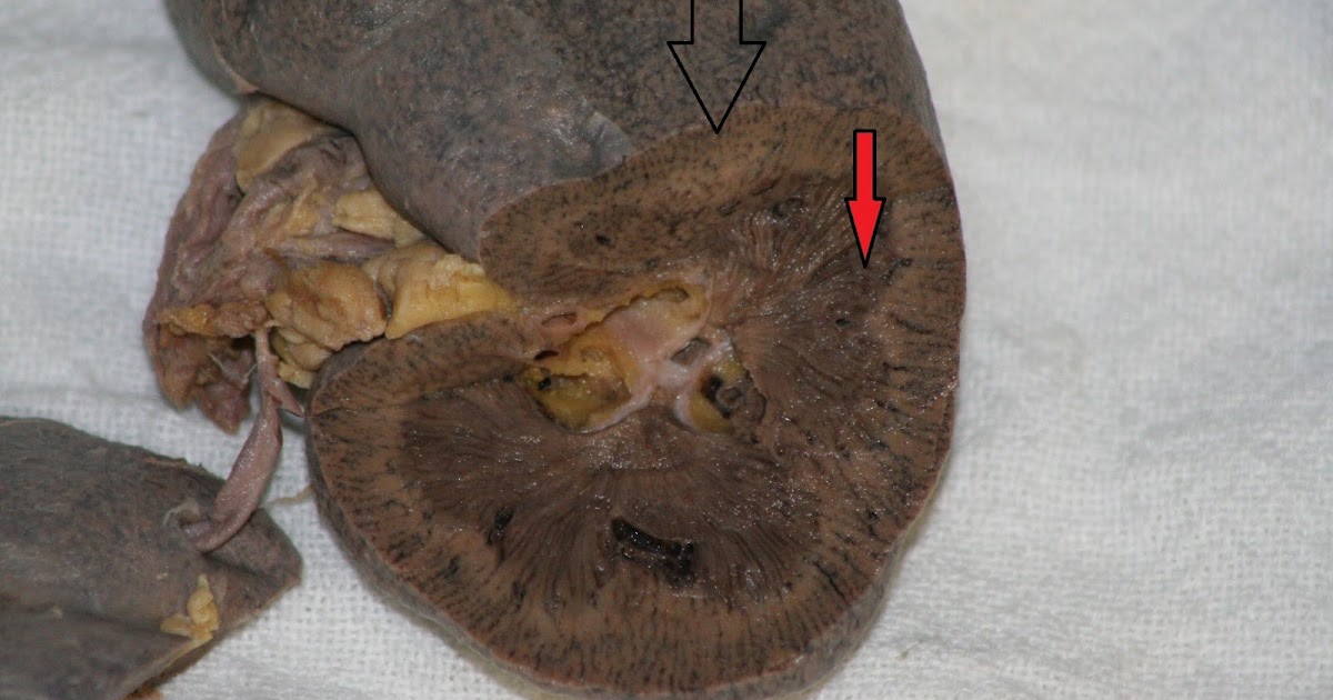 morfologia e histologia do Rim