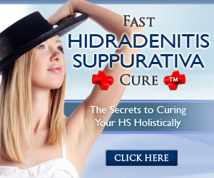 Fast Hidradenitis Suppurativa Cure - Natural Treatment for HS