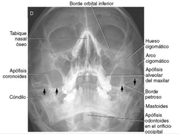 proyeccionesradiologicas: Waters