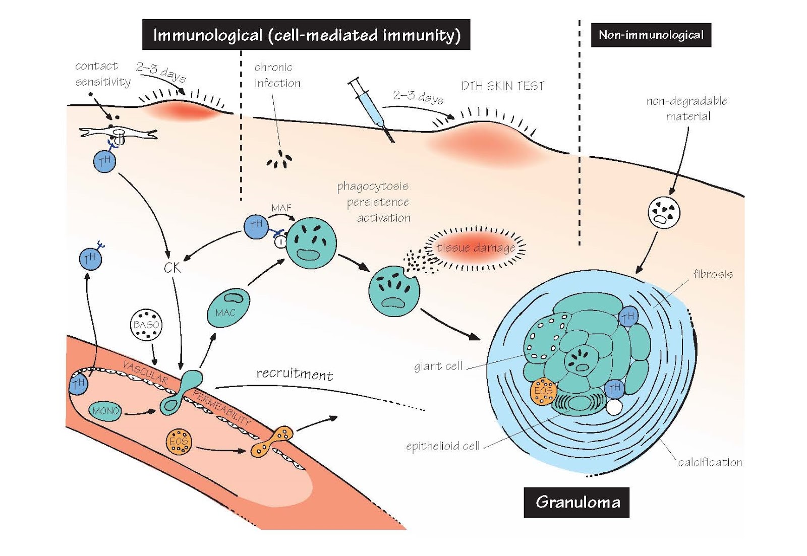 Chronic And Cell-Mediated Inflammation - pediagenosis