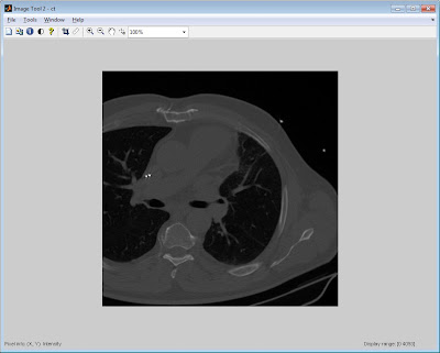 Health Informatics @ PolyU: HTI 5720 Digital Imaging and PACS ...