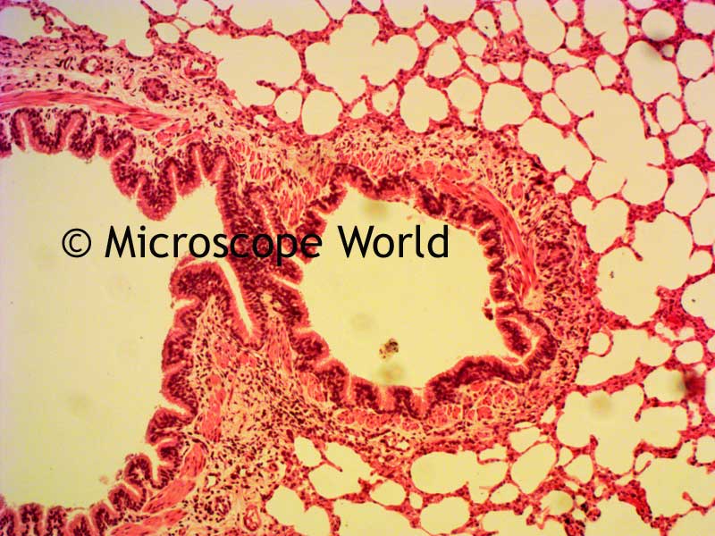 Microscope World Blog: Lung Tissue