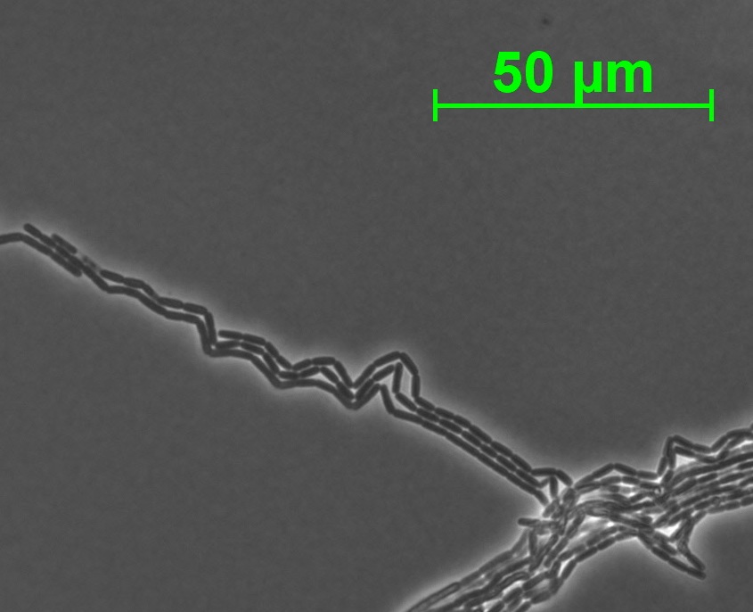 Of Bacteria and Men: Filamentous bacteria under the microscope