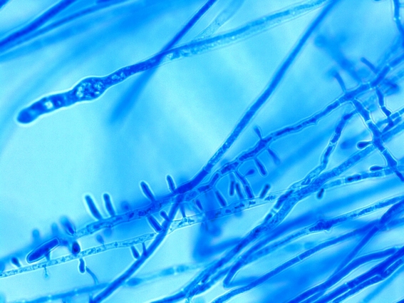 Fun With Microbiology (What's Buggin' You?): Trichophyton tonsurans