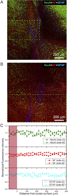 Our Parkinson's Place: Your brain on mesh: Injectable flexible probe ...